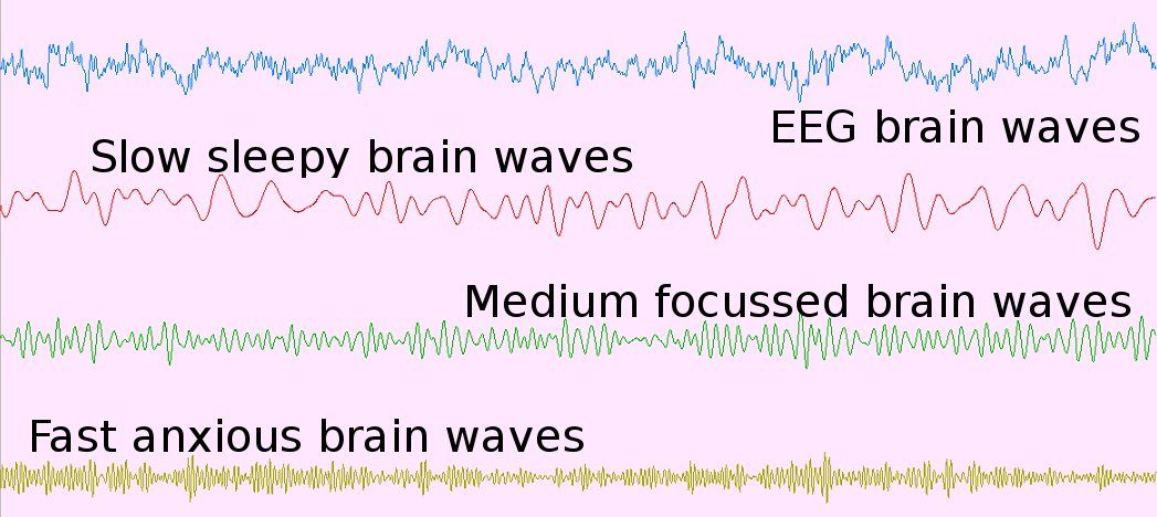 What to expect in a training session - Edinburgh Neurofeedback